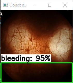 GitHub - TeamUltF4/WCEBleedgen_tensor