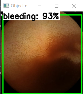 GitHub - TeamUltF4/WCEBleedgen_tensor