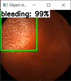 GitHub - TeamUltF4/WCEBleedgen_tensor