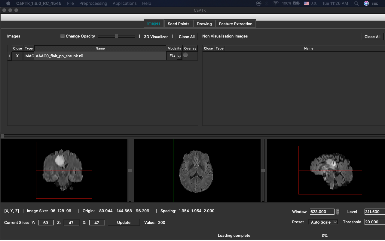 CaPTk not rendered correctly on certain screen sizes in macOS · Issue #137 · CBICA/CaPTk · GitHub
