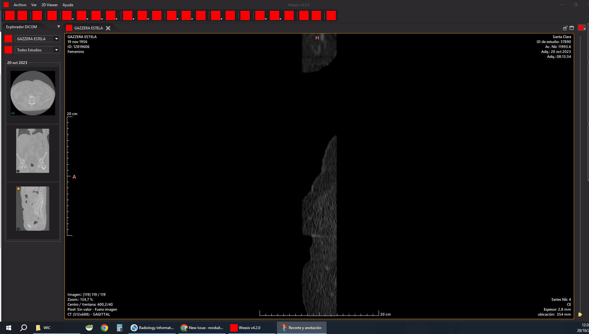 Defect on screen (everything red) · Issue #478 · nroduit/Weasis · GitHub
