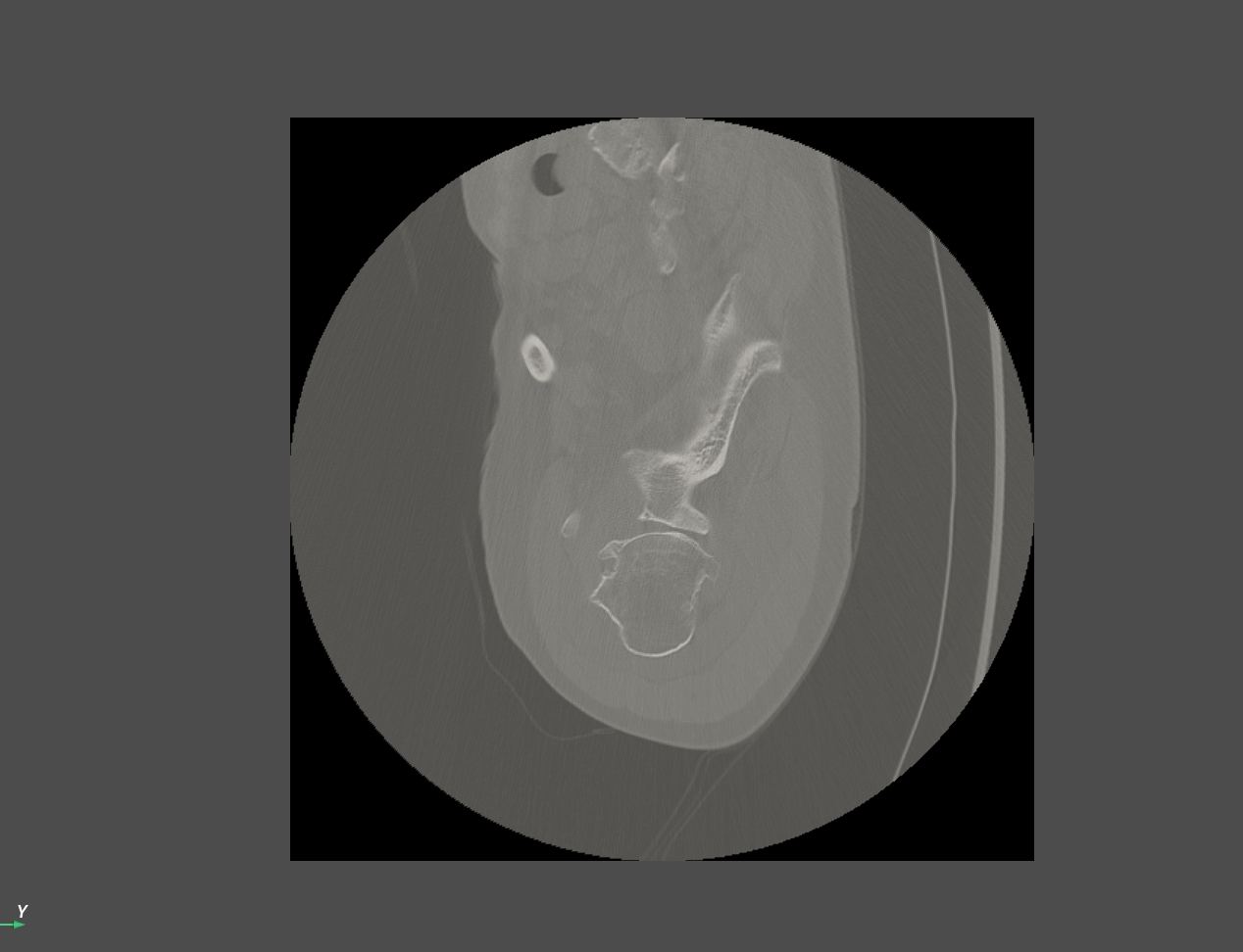 Plot DICOM slice and segmentation mask with transparency · pyvista ...