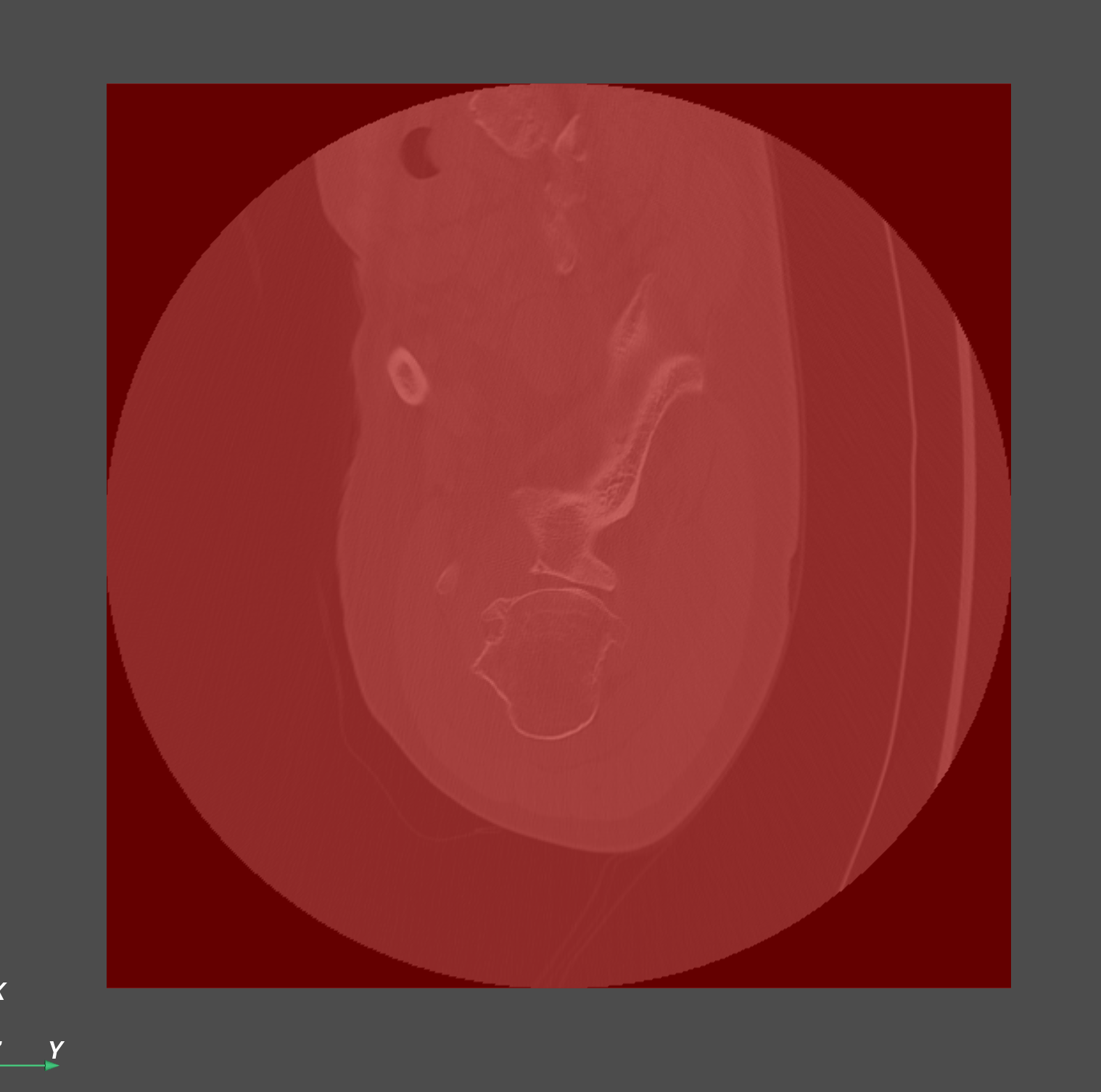 Plot DICOM slice and segmentation mask with transparency · pyvista ...