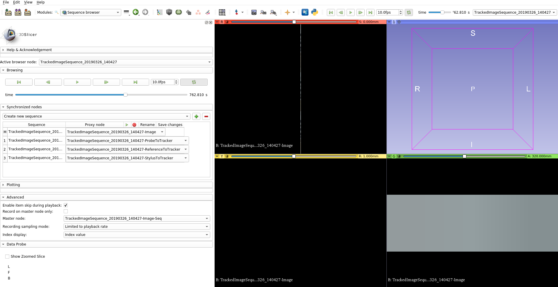 Record and replay color sequence file · Issue #516 · PlusToolkit/PlusLib · GitHub