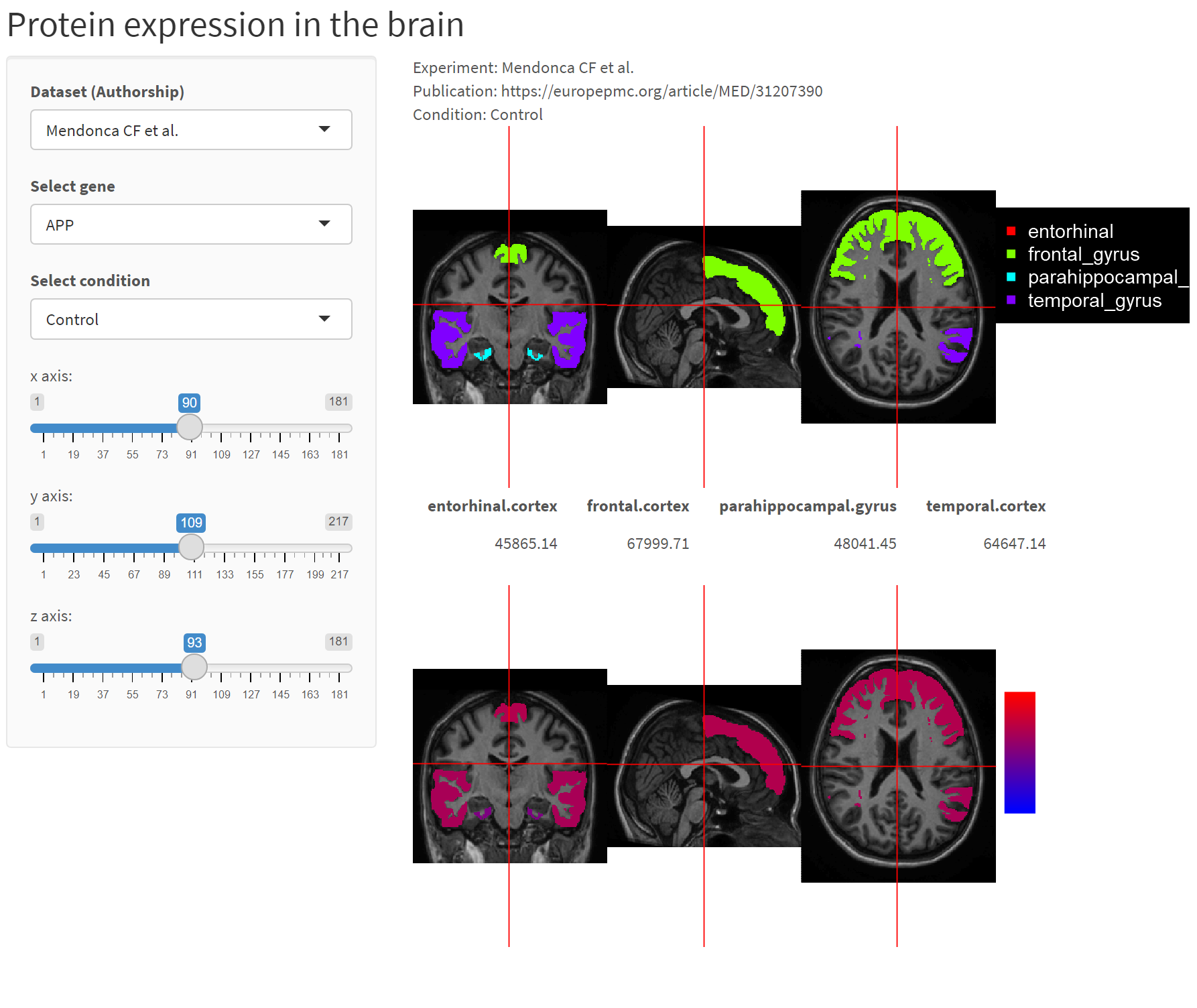 GitHub - davco/ProteomeBrainApp