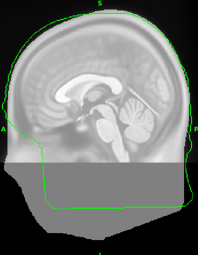 new method for defacing MRI (3D and 4D volume) · Issue #307 ...