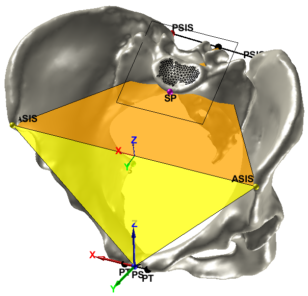 GitHub - RWTHmediTEC/PelvicLandmarkIdentification: MATLAB function for the automatic ...