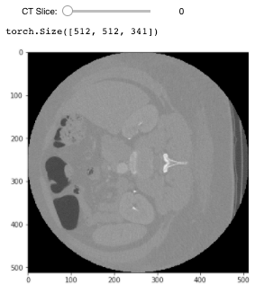 Augmentation not working as expected · Issue #122 · TorchIO-project/torchio · GitHub