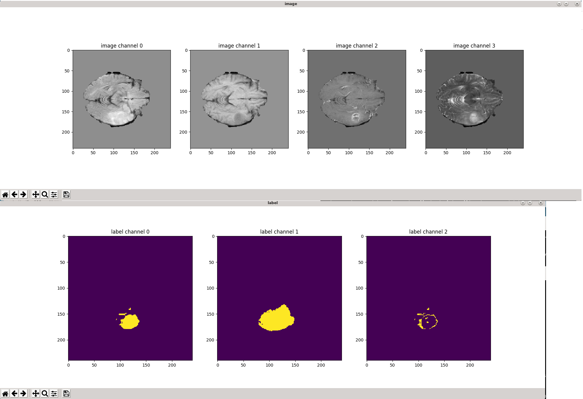 Problem With 3dsegmentationbratssegmentation3dipynb · Issue 392 · Project Monaitutorials 5033