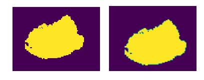 Problem with 3d_segmentation/brats_segmentation_3d.ipynb · Issue #392 · Project-MONAI/tutorials ...
