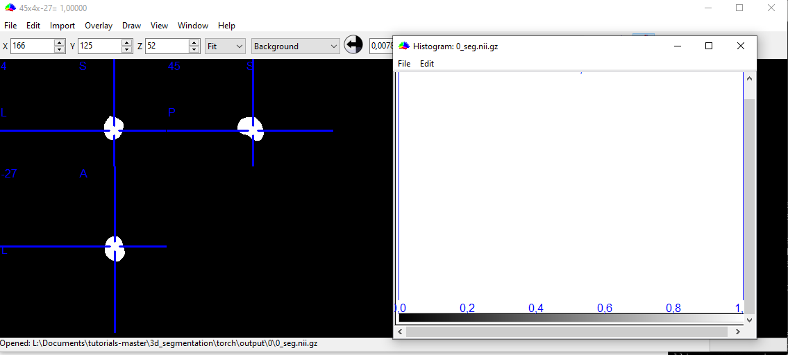 Problem with 3d_segmentation/brats_segmentation_3d.ipynb · Issue #392 · Project-MONAI/tutorials ...