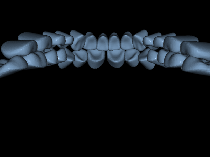 Wrong visualization results · Issue #3 · SJTUzhou/3D-Teeth ...