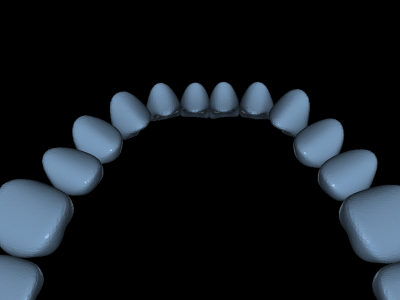 Wrong visualization results · Issue #3 · SJTUzhou/3D-Teeth-Reconstruction-from-Five-Intra-oral ...