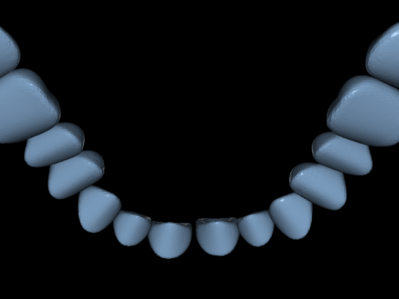 Wrong visualization results · Issue #3 · SJTUzhou/3D-Teeth-Reconstruction-from-Five-Intra-oral ...