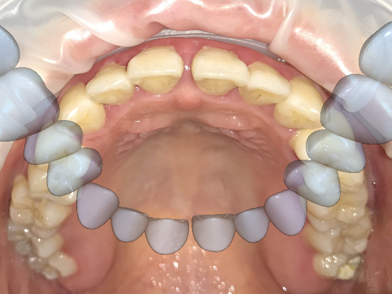 Wrong visualization results · Issue #3 · SJTUzhou/3D-Teeth ...
