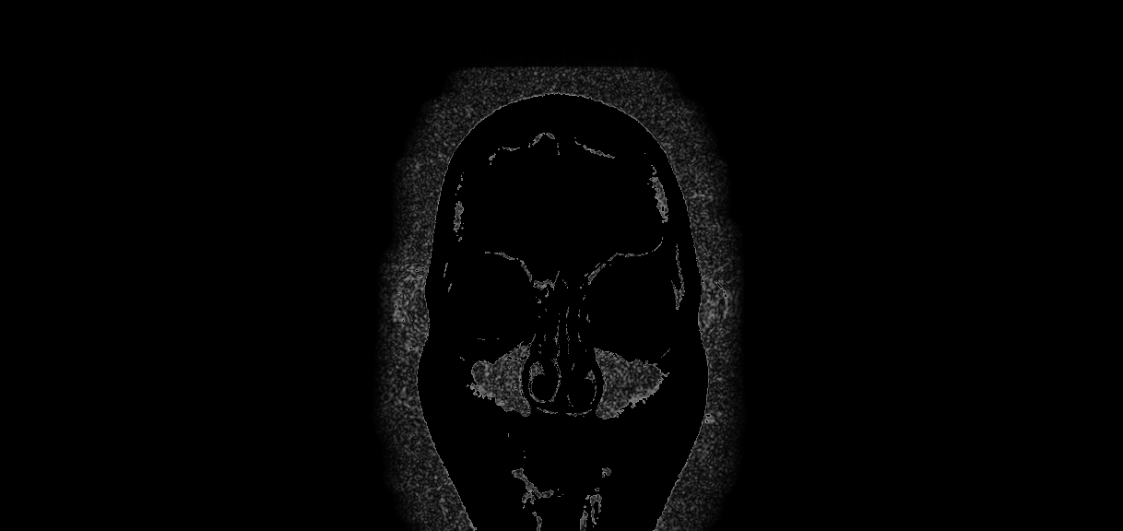 Problem with displaying DICOM · Issue #429 · cornerstonejs/cornerstone · GitHub