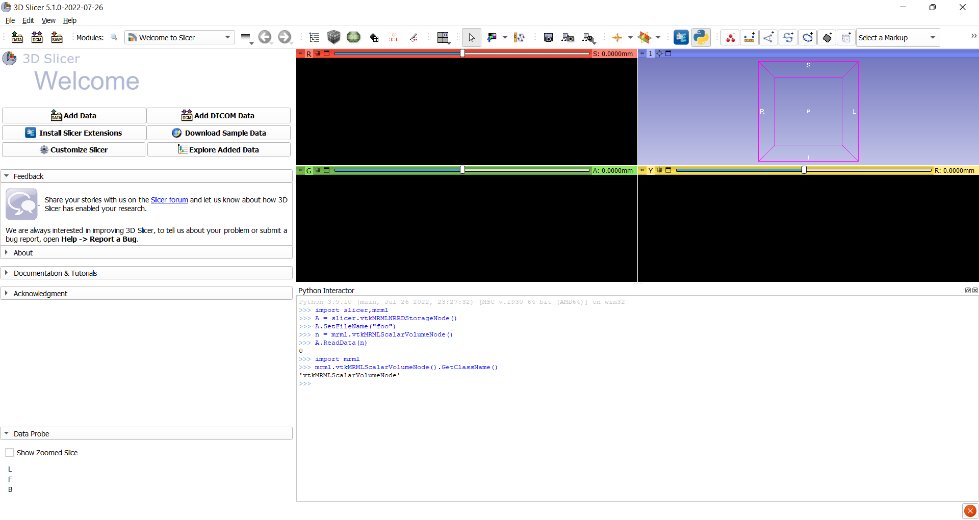 Pythonslicer Problem With Vtk And Readdata · Issue 6484 · Slicerslicer · Github 3519