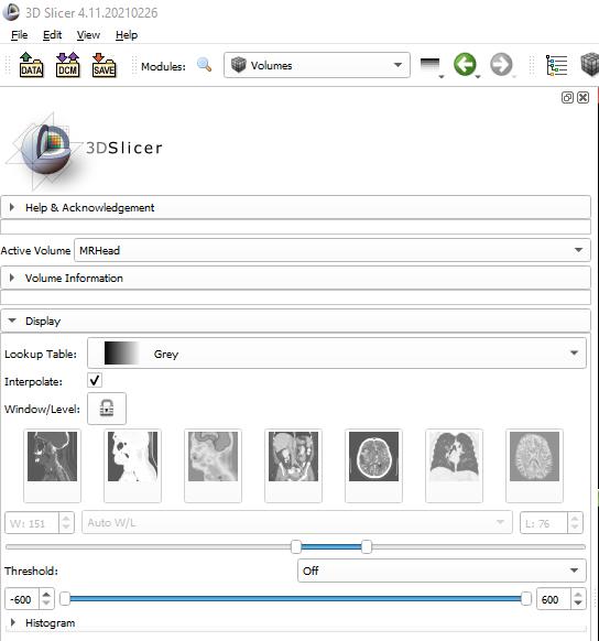 Volumes module w/l lock does not lock w/l slider · Issue #6738 · Slicer/Slicer · GitHub