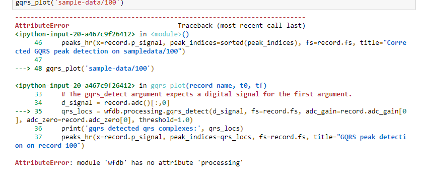 Demo 13 14 15 Failed · Issue 92 · Mit Lcp Wfdb Python · Github