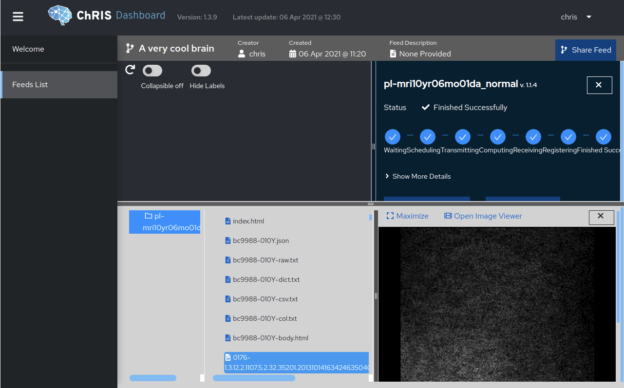 ChRIS UI: Create small React widget to display thumb for medical images, to be used in ChRIS UI ...