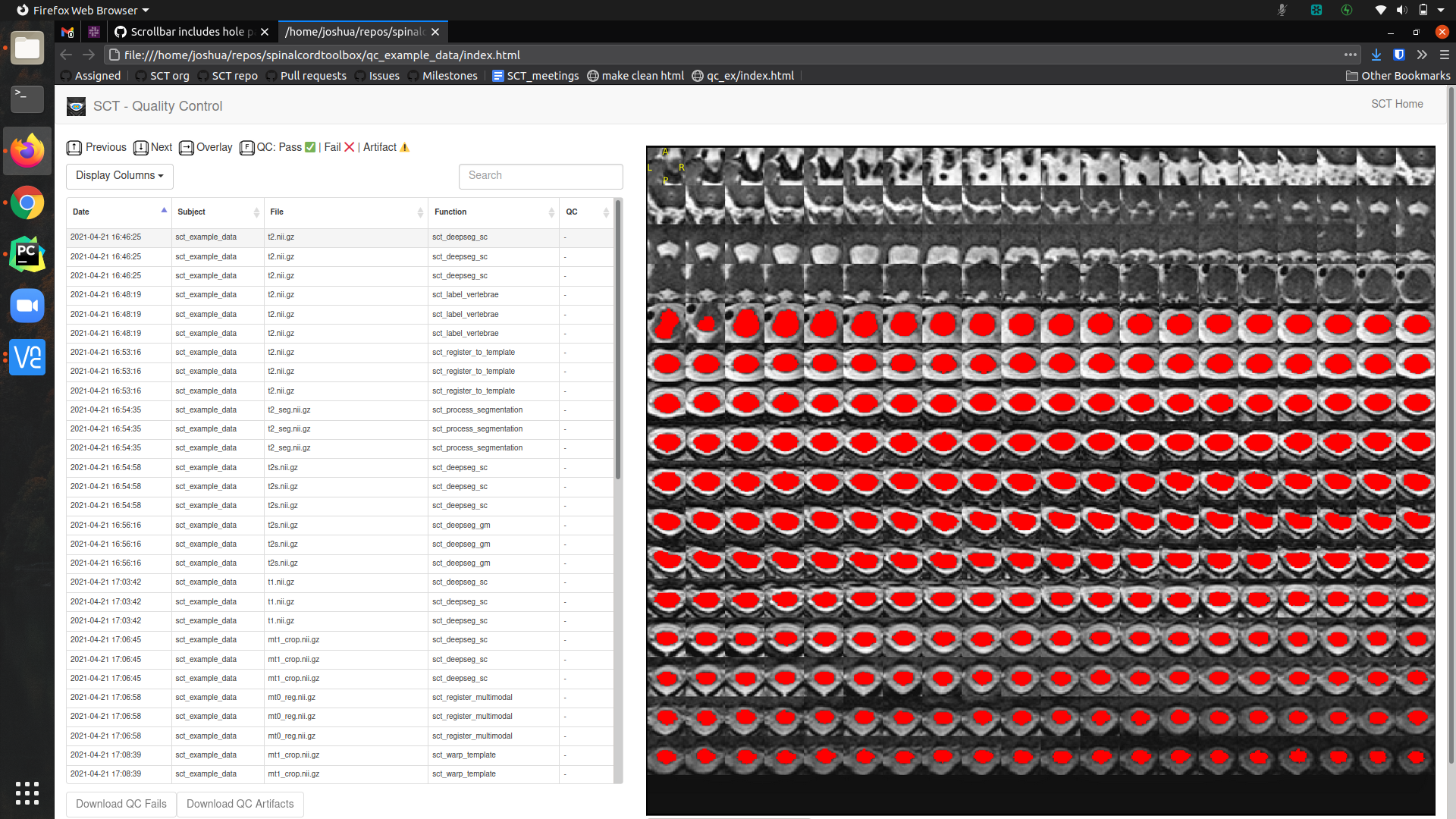 Scrollbar includes hole page in html QC report · Issue #3384 · spinalcordtoolbox ...