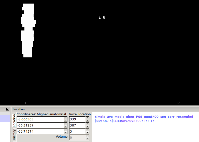 Morphometric values are reported in slices that are not segmented · Issue #3402 ...