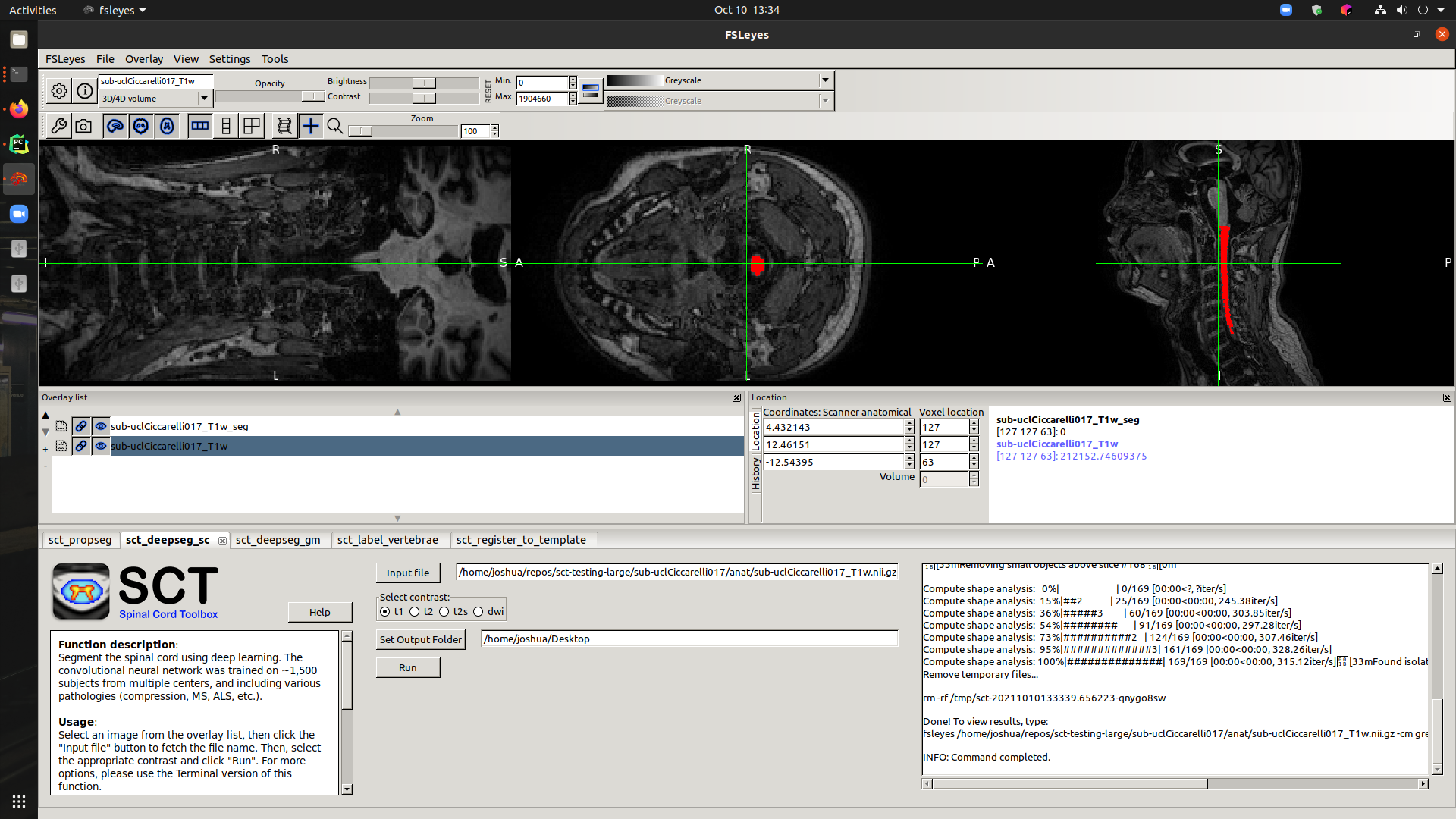 FSLeyes script doesn't work :-( · Issue #3533 · spinalcordtoolbox/spinalcordtoolbox · GitHub