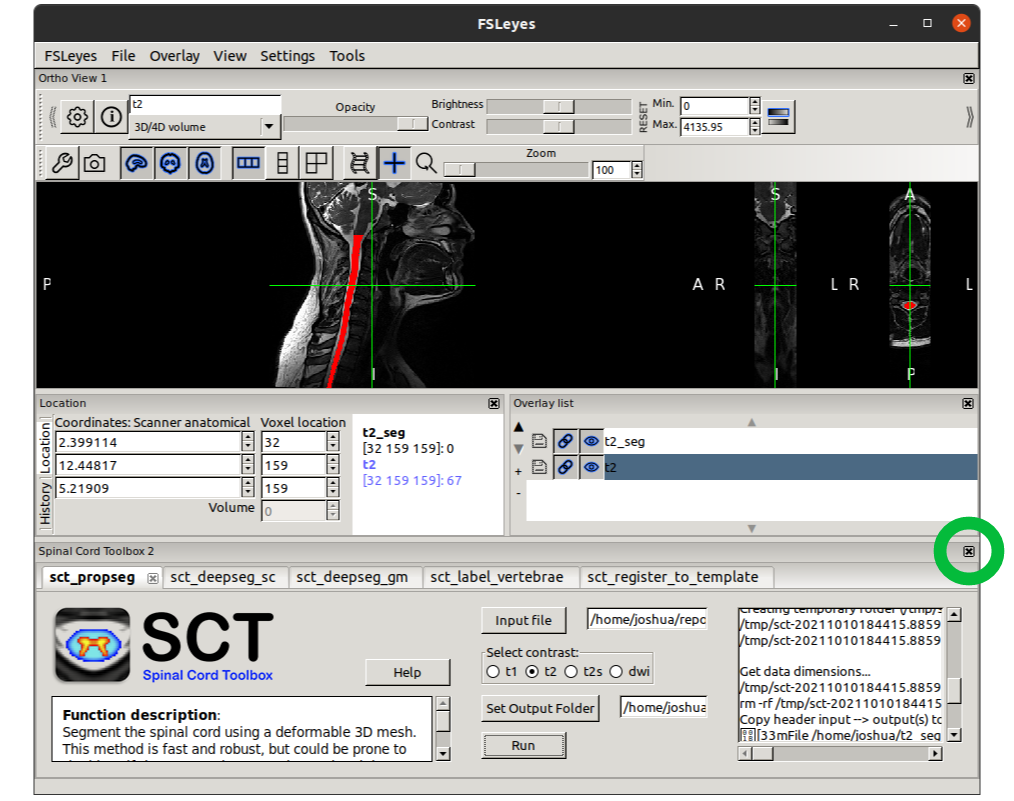 FSLeyes can't close when SCT plugin is loaded · Issue #3537 ...