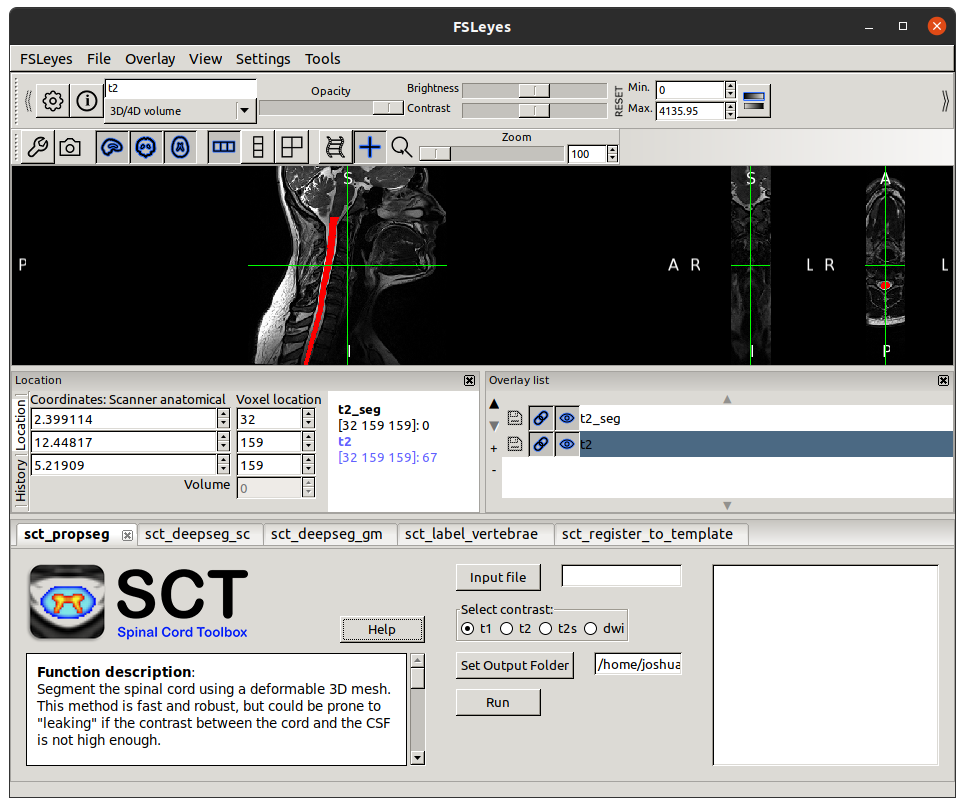 FSLeyes can't close when SCT plugin is loaded · Issue #3537 · spinalcordtoolbox ...