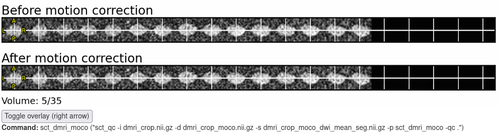 `sct_qc` displays the wrong arguments/command · Issue #3356 · spinalcordtoolbox ...
