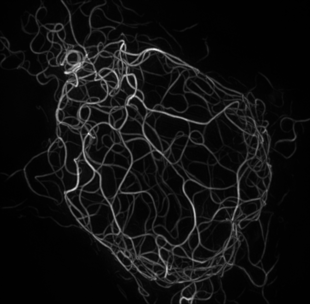 GitHub - CigdemSazak/phase-congruency-tensor-3d: 3D curvilinear structure enhancement based on ...