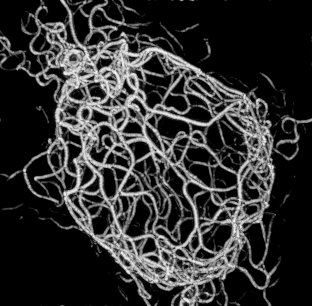 GitHub - CigdemSazak/phase-congruency-tensor-3d: 3D curvilinear structure enhancement based on ...