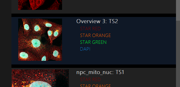 GitHub - nranthony/abberior-files