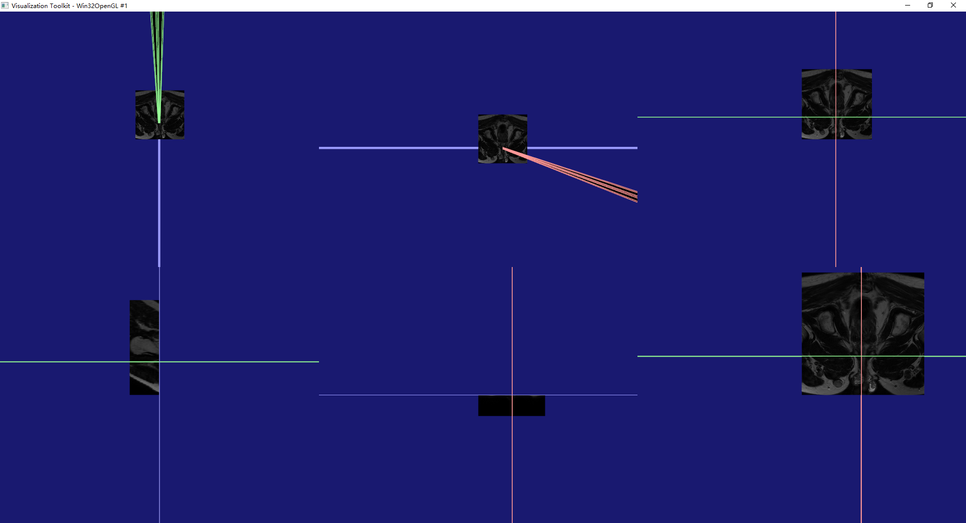 GitHub - kangaroolove/VTK-examples