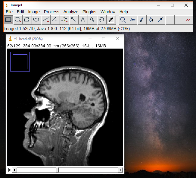 Bad scrollbar handle visibility on Windows 10 using ImageJ 1.52r (and previous versions) · Issue ...