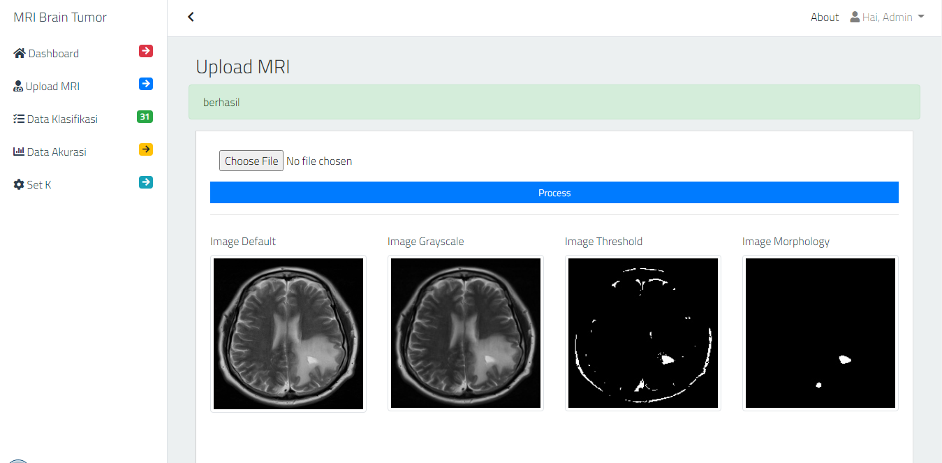 GitHub - SinghSujitkumar/otakular: website for classification of brain ...