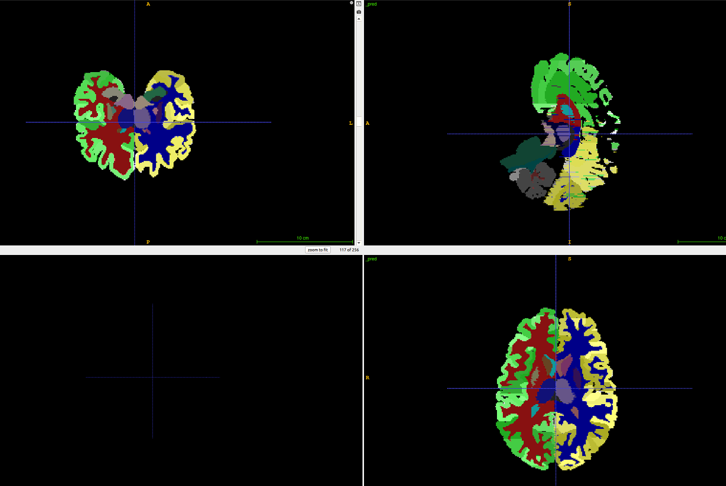 ACEnet issues · Issue #1 · ymli39/ACEnet-for-Neuroanatomy-Segmentation · GitHub