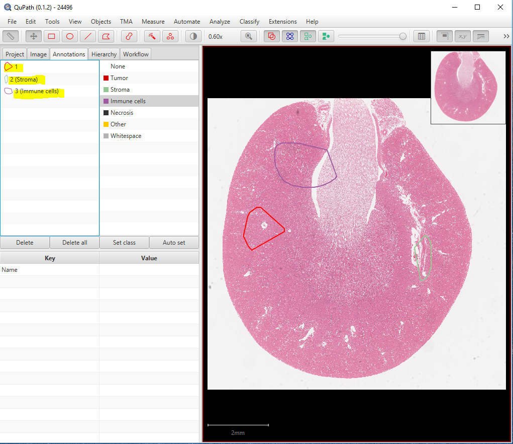 Annotations UUID · Issue #3 · bcgsc/qupath-annotation-exchange · GitHub