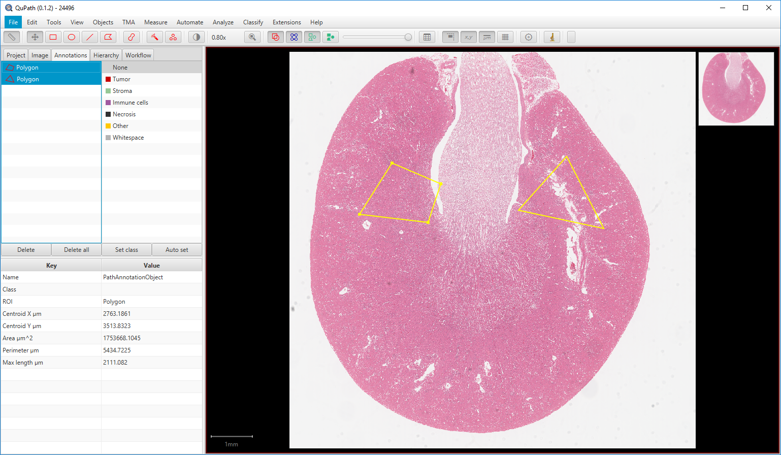 Annotations UUID · Issue #3 · bcgsc/qupath-annotation-exchange · GitHub