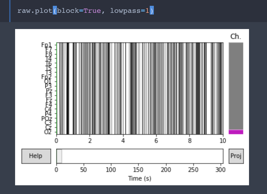 Rawplot Does Not Work On My Data · Issue 5539 · Mne Toolsmne Python · Github