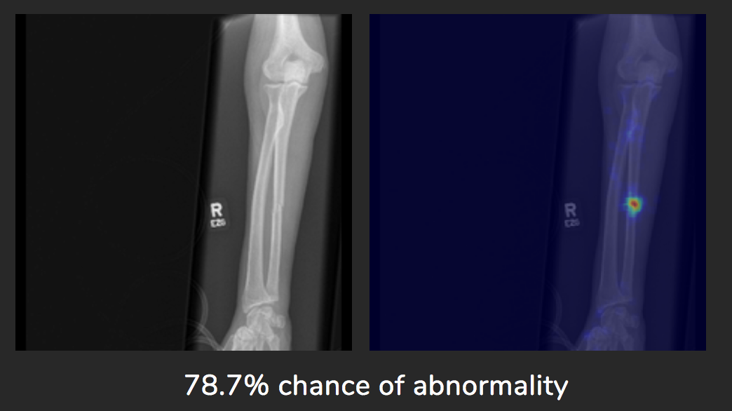 X Ray Vision App