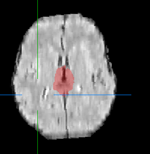 Coregister for label doesn't work correctly · Issue #141 · ANTsX/ANTsPy · GitHub