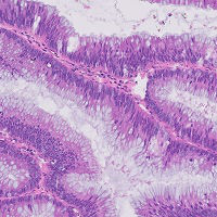 Inconsistent output read_region() local vs server · Issue #66 · openslide/openslide-python · GitHub