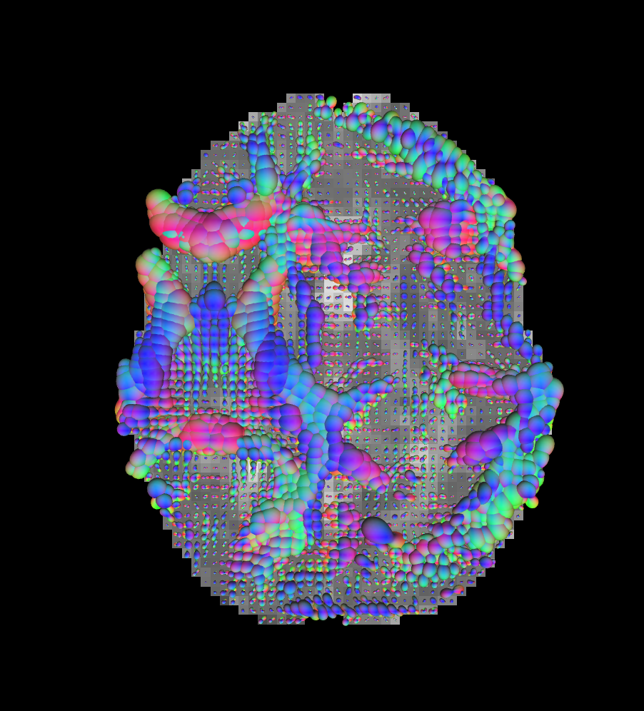 [BUG] Incorrect ODF placement going from DIPY->DSI Studio · Issue #38 · PennLINC/qsirecon · GitHub