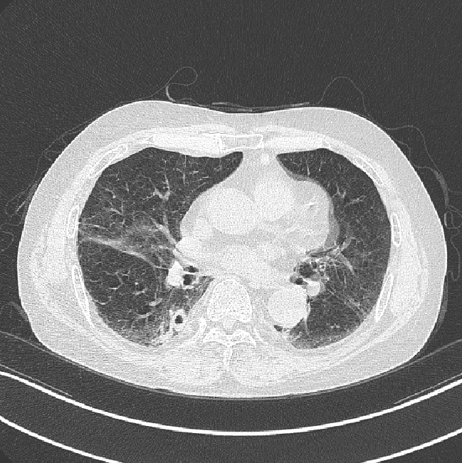 GitHub - leegaeun/CT_Kernel_Conversion
