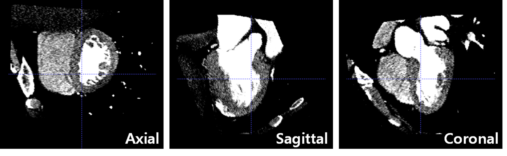 GitHub - leegaeun/Cardiac_Segmentation