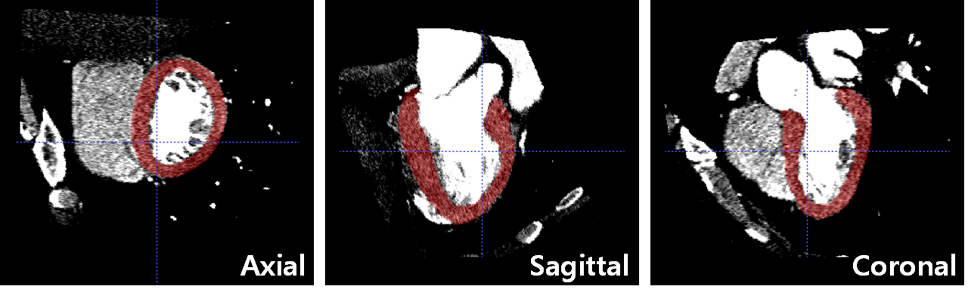 GitHub - leegaeun/Cardiac_Segmentation