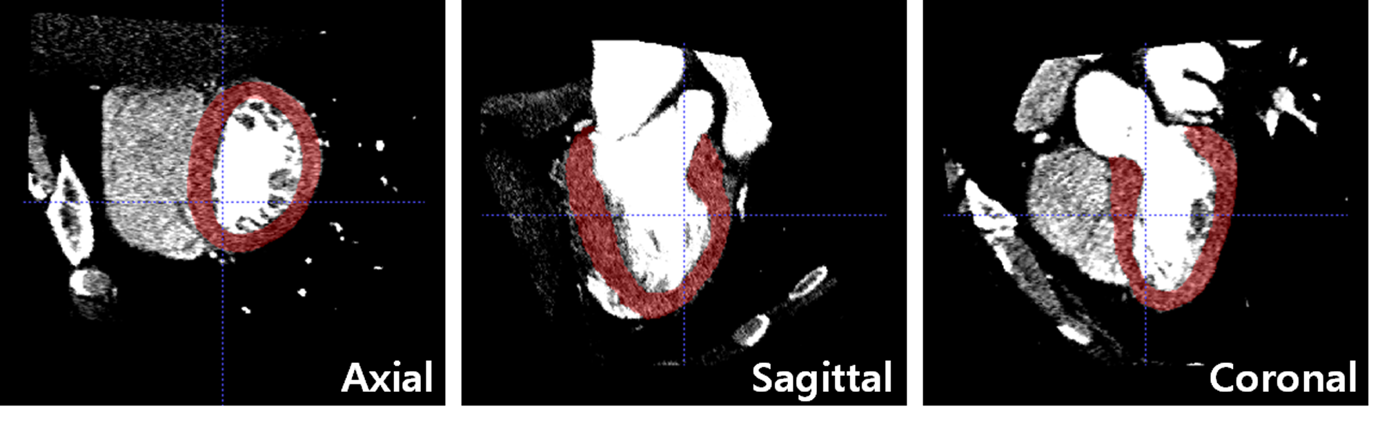 GitHub - leegaeun/Cardiac_Segmentation