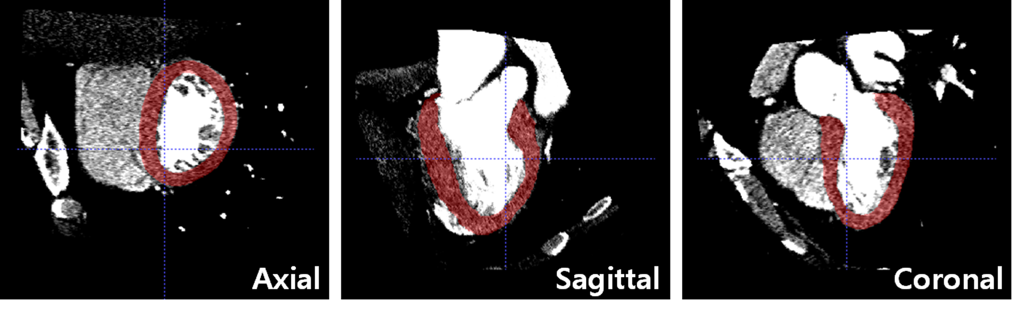 GitHub - leegaeun/Cardiac_Segmentation