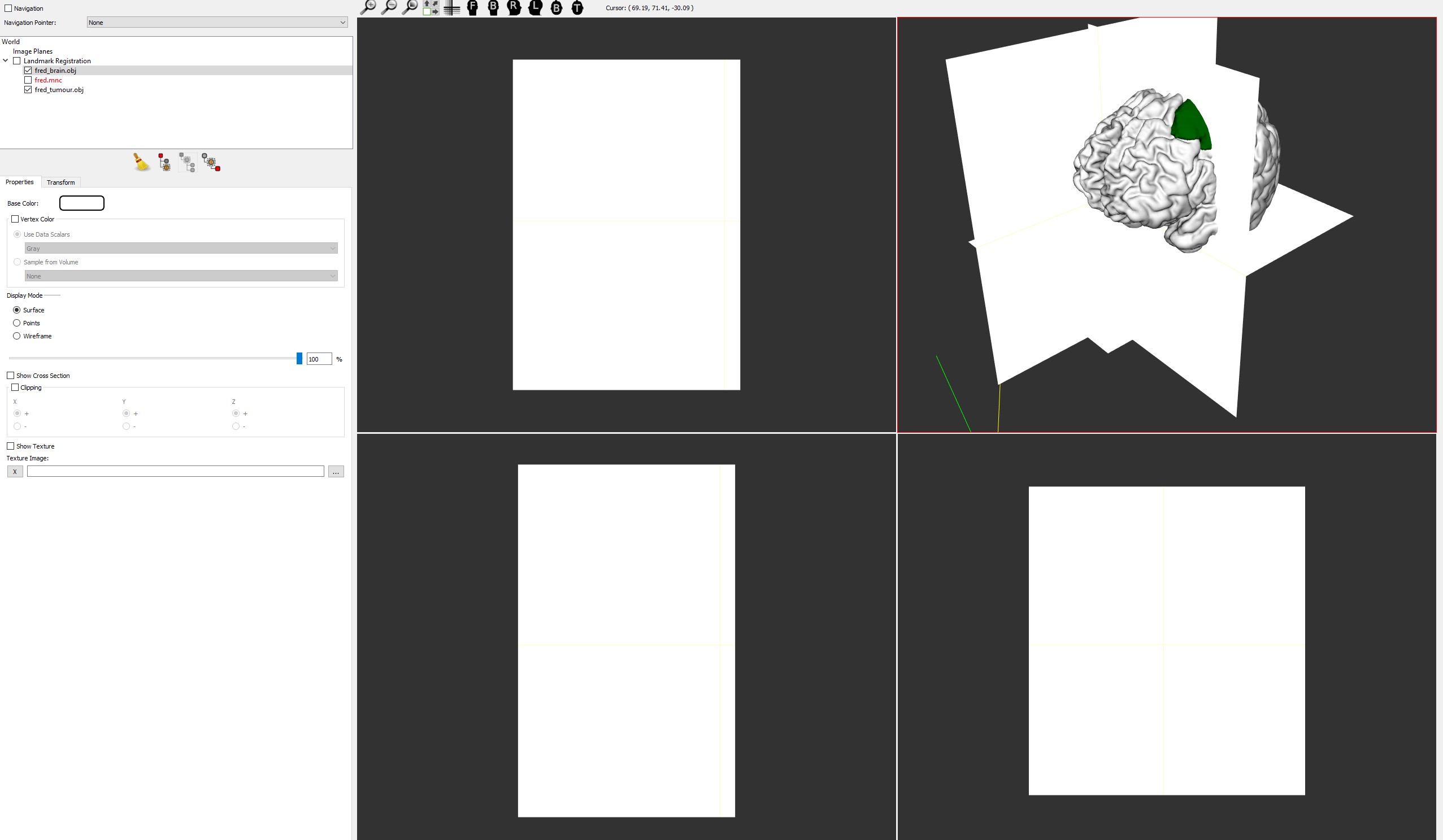 Cut planes all white when volume unchecked · Issue #494 · IbisNeuronav/Ibis · GitHub